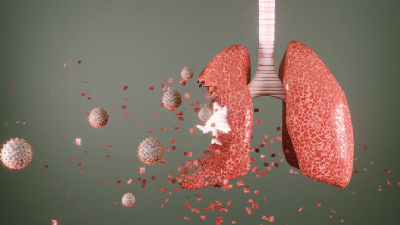 Lung Damage: ಕೊವಿಡ್ ನಂತರ ಶ್ವಾಸಕೋಶದ ತೊಂದರೆ ಹೆಚ್ಚಳ; ಅಧ್ಯಯನ - Kannada News ...