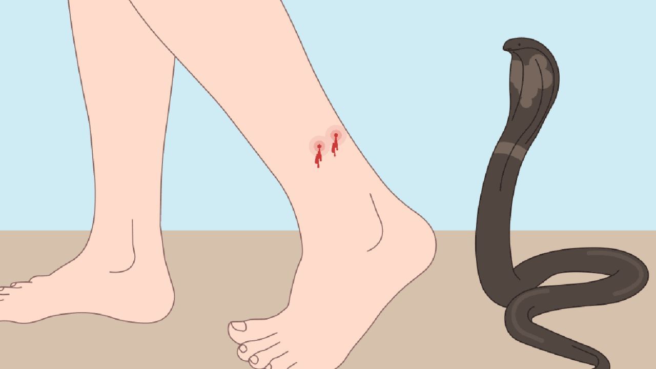 ರಾಜ್ಯದಲ್ಲಿ ಹಾವು ಕಡಿತ ಪ್ರಕರಣ ಹೆಚ್ಚಳ: 10 ತಿಂಗಳಲ್ಲಿ 18 ಸಾವಿರ ಕೇಸ್ , 125 ಮಂದಿ ಸಾವು - Kannada News ...